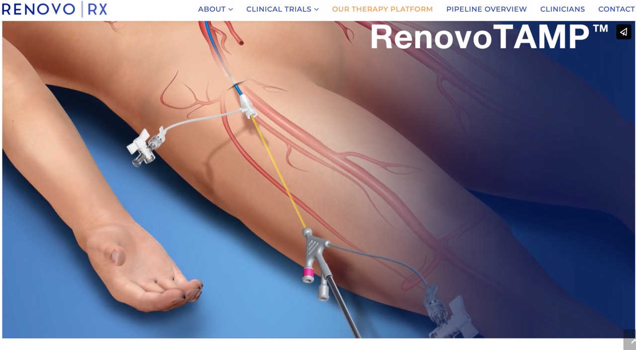 4172 因華 - https://renovor...｜CMoney 股市爆料同學會